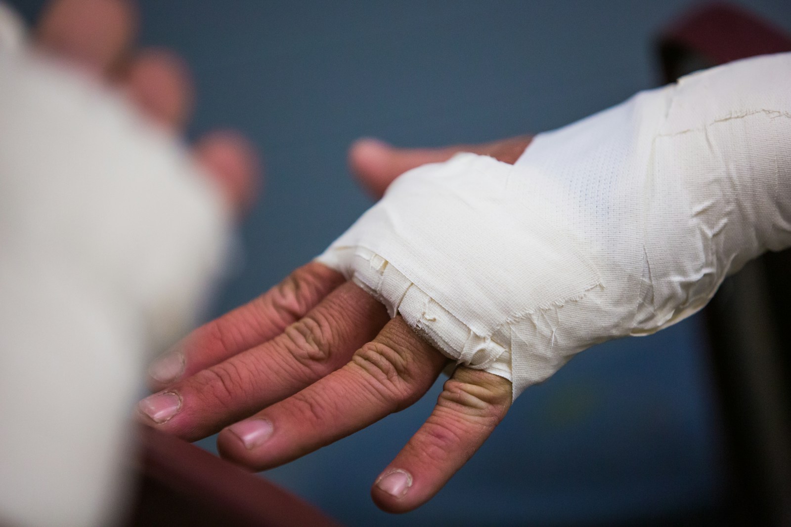 Private Hand Surgery | Consultants Choice
